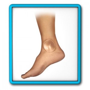 Bunga Gel Discs malleolar protection - SPORTS DE GLACE France